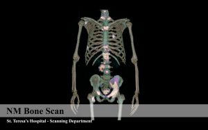 NM | 聖德肋撒醫院-掃描部 | St. Teresa’s Hospital-Scanning Department