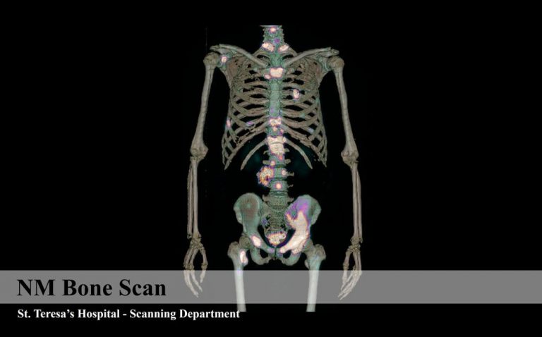 NM | 聖德肋撒醫院-掃描部 | St. Teresa’s Hospital-Scanning Department