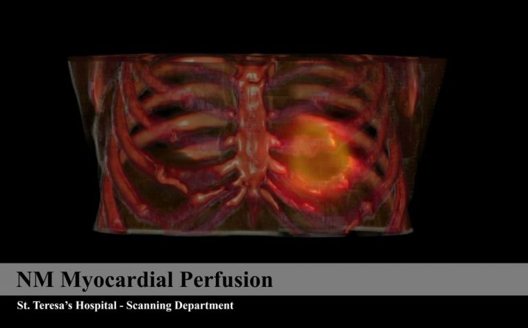 NM | 聖德肋撒醫院-掃描部 | St. Teresa’s Hospital-Scanning Department