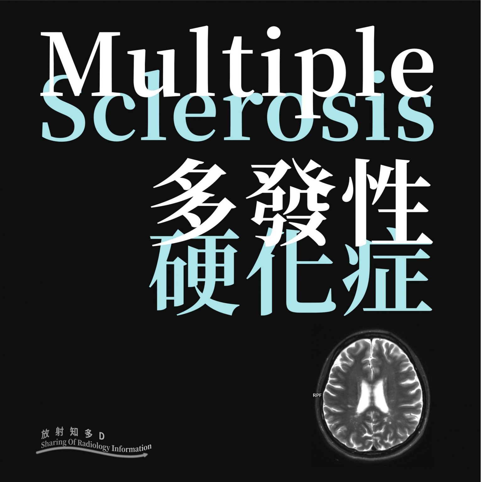 Are headaches and numbness in hands & feet the early signs of Multiple ...